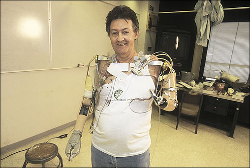 The Bionic Man - The Boston Globe
